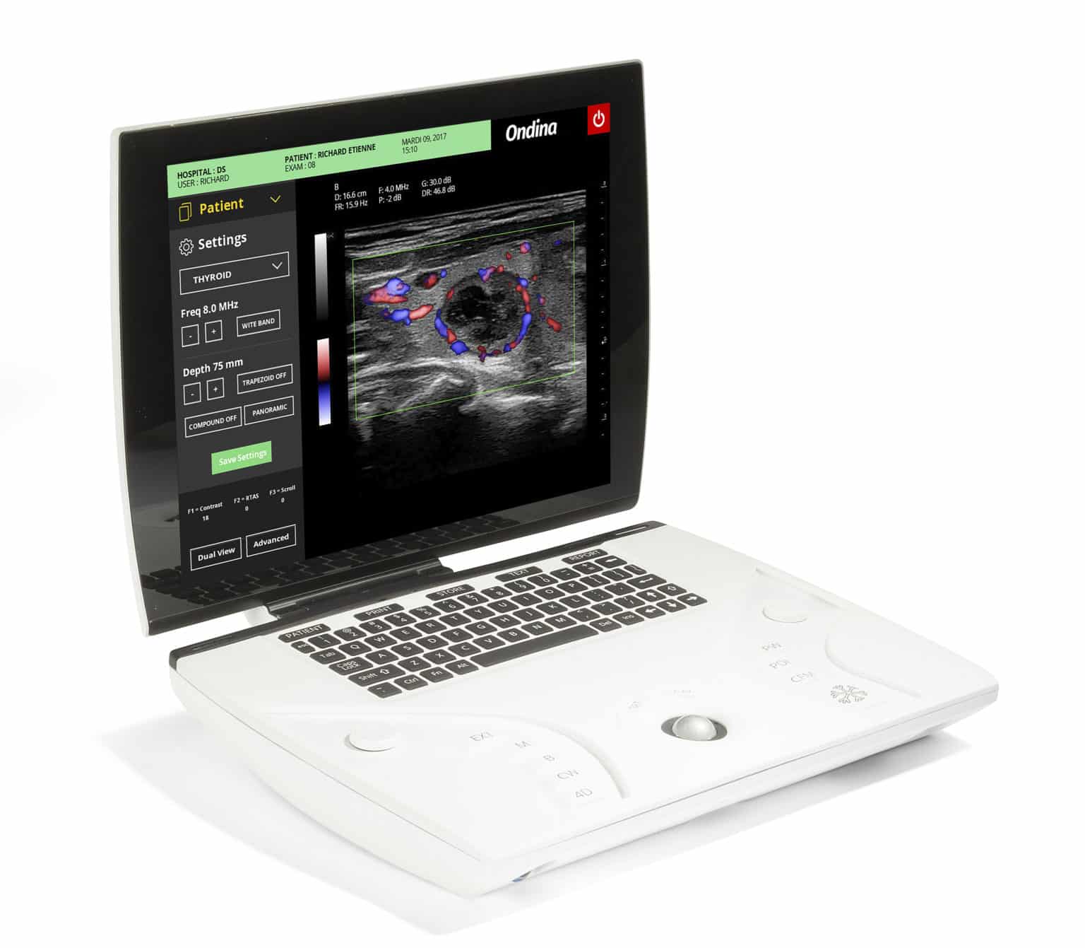 Sonoscanner : Premium Diagnostic Ultrasound