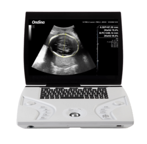 Obstetrics & Gynecology Ultrasound Scanner Machine - Sonoscanner