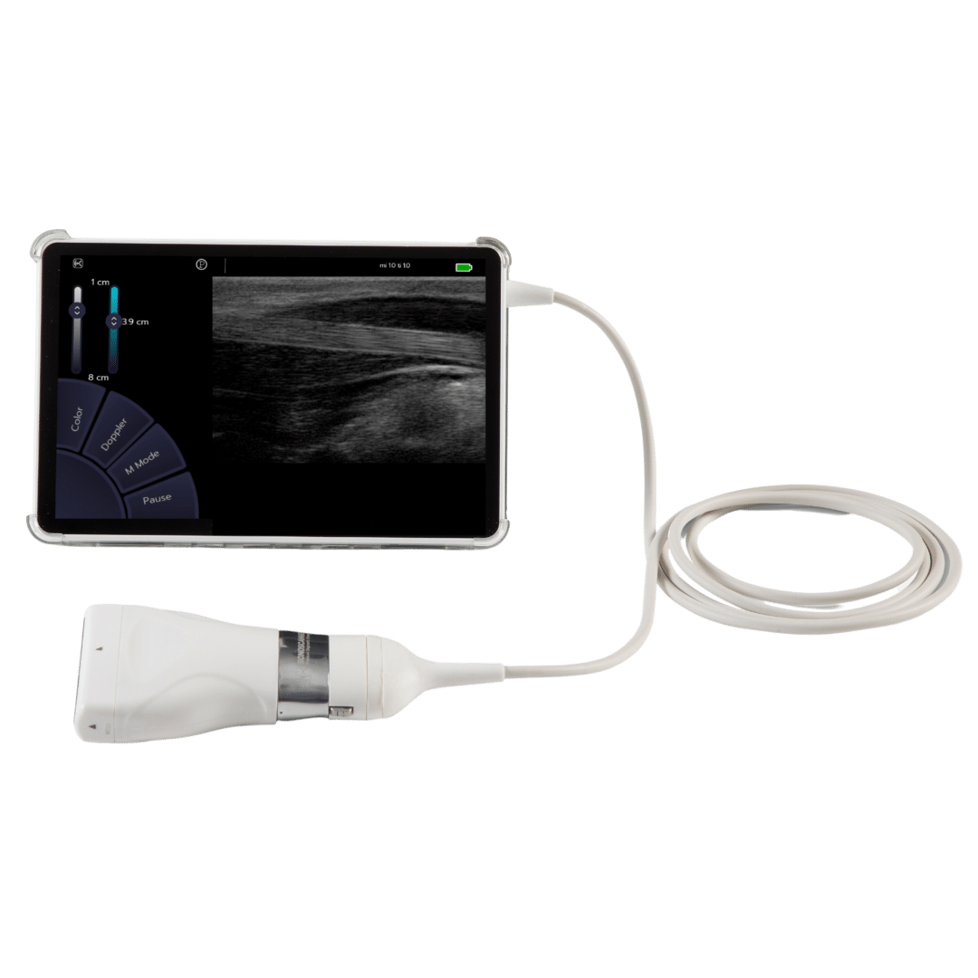 U-Lite PRO - HandHeld Ultrasound Scanner - Sonoscanner