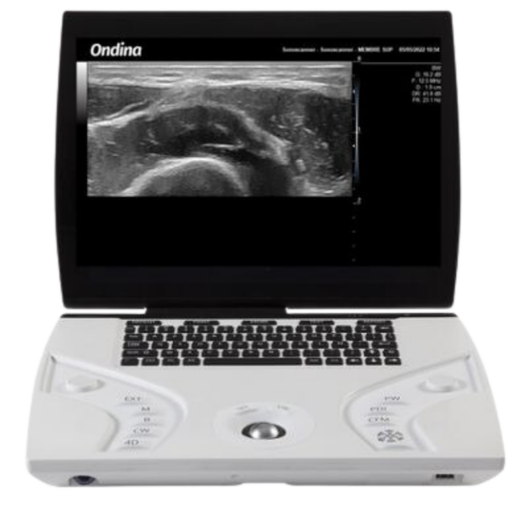 Ecogenicidad: definición, guía y prácticas | Sonoscanner