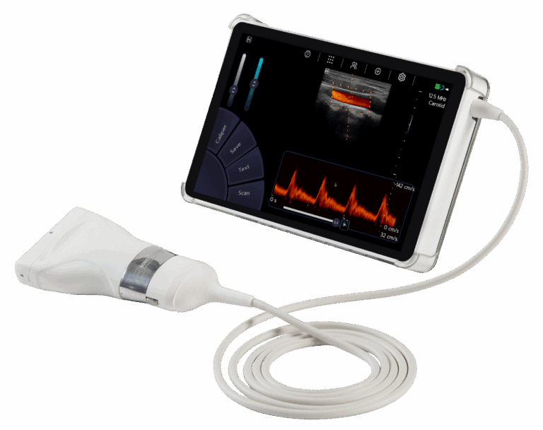 Artificial Intelligence and Ultrasound | Sonoscanner