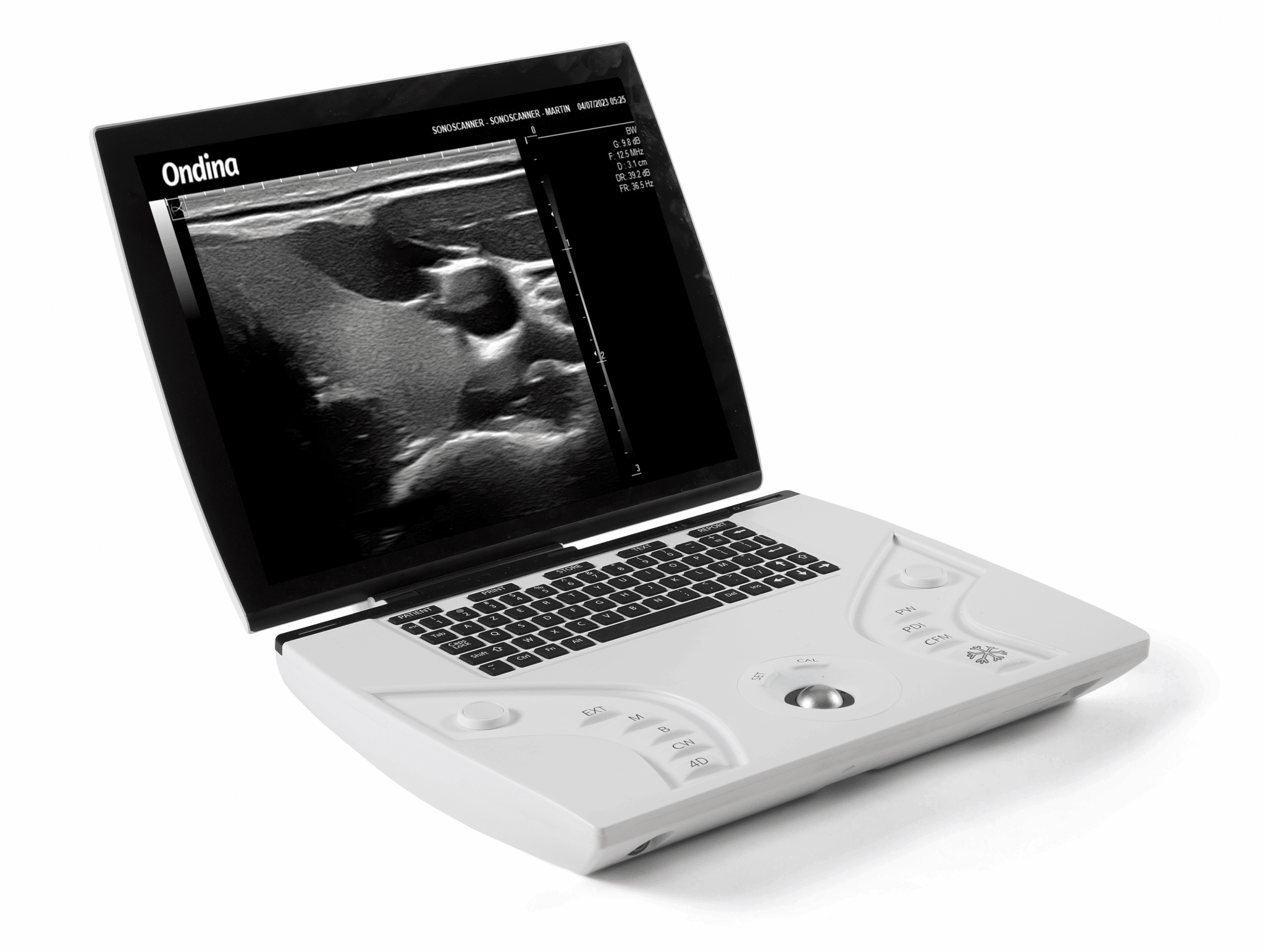 POCUS Ultrasound: Comprehensive Guide | Sonoscanner